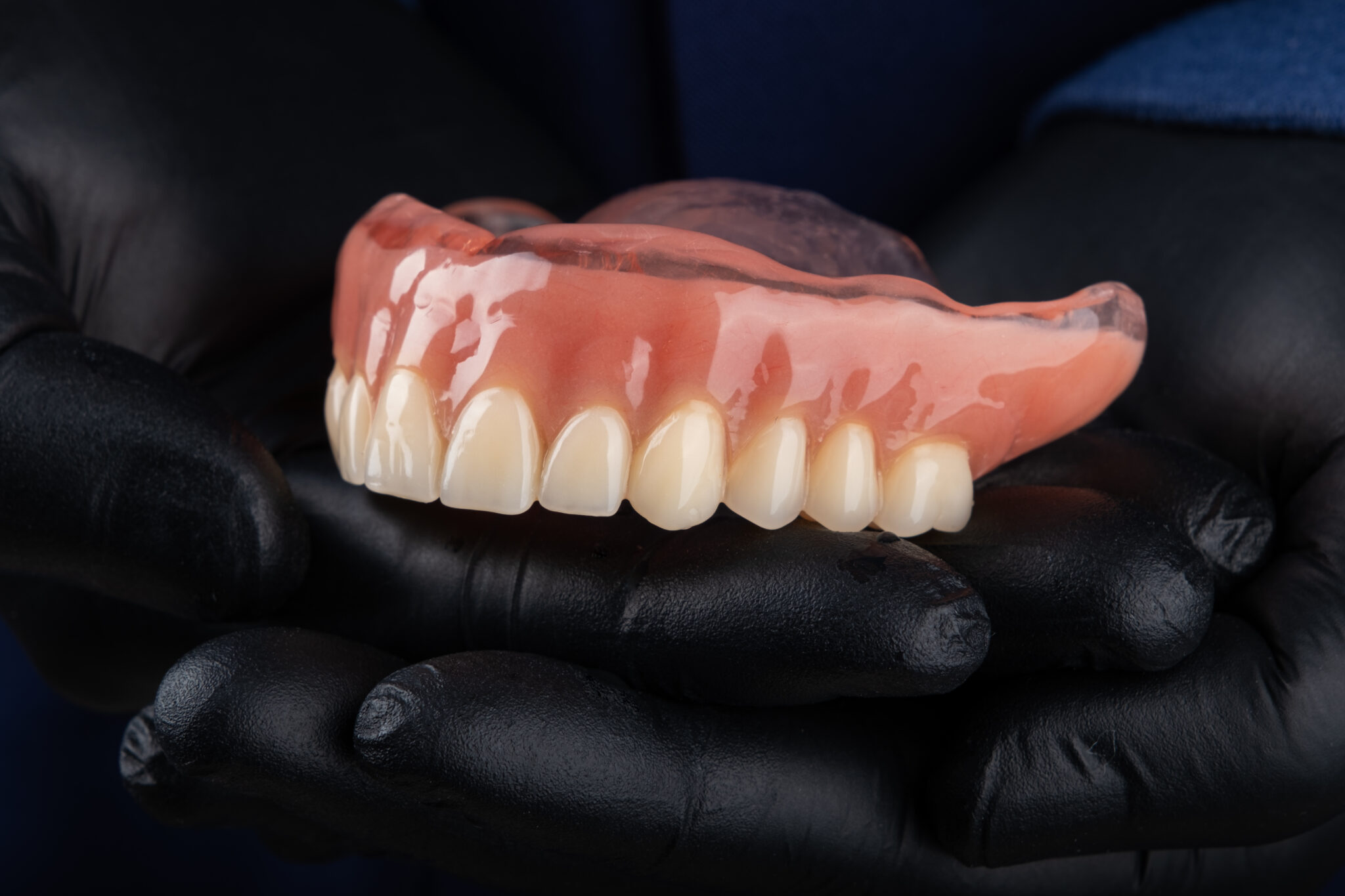 Navigating the Denture Fitting Process with Ease | Joondana Family ...